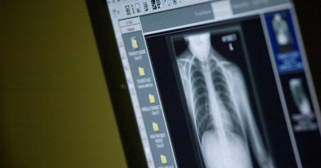 'Severe harm' to patients caught up in huge x-rays backlog | HSJ Local ...