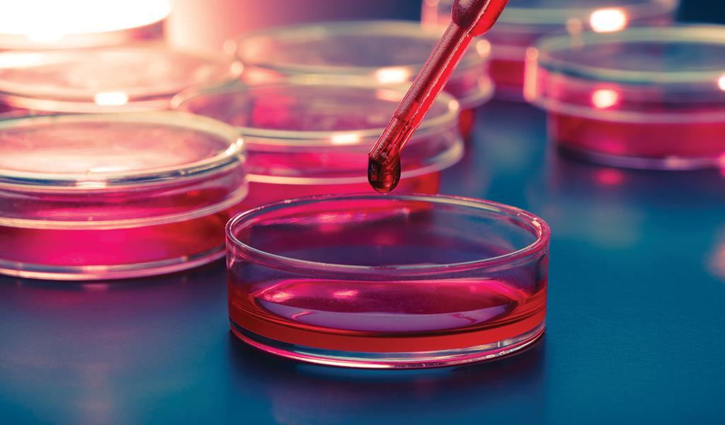 NHSI 'impressed' with five pathology network launches | News | Health ...