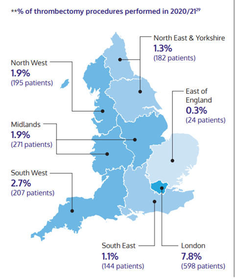 thrombectomy centres uk