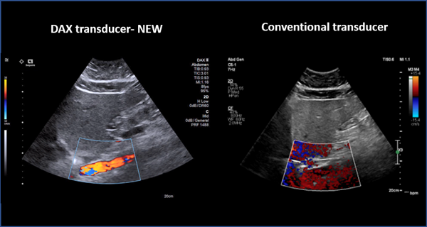 Ultrasound can provide diagnostic quality images in obese patients ...
